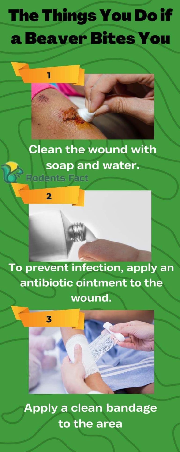 Do Beaver Bites Hurt? Concerning Fact or Normal?